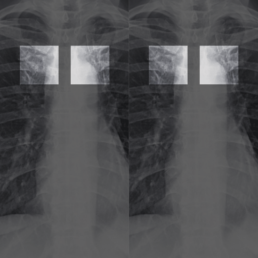 JVC to launch the CL-S600, a 30-inch medical imaging monitor | News | Healthcare | Professional ...