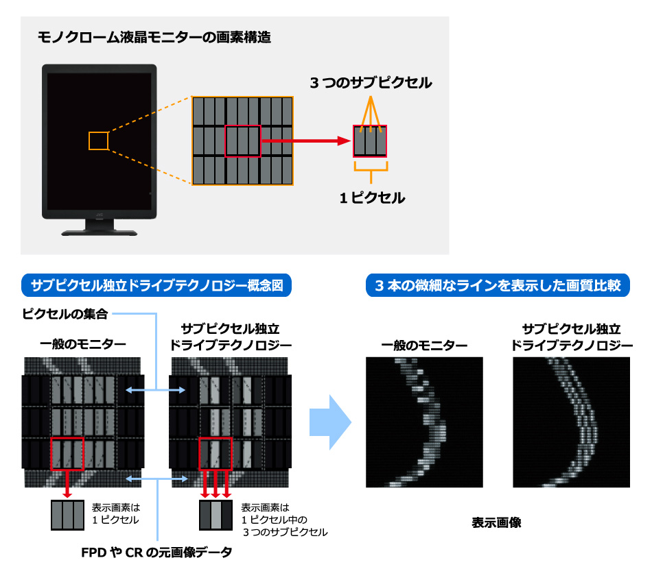 300万画素21.3型モノクローム液晶モニターMS-S300 | ヘルスケアシステム | JVC