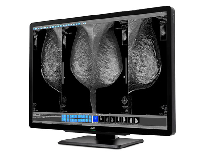 National Cancer Center Hospital | Case Studies | Healthcare ...