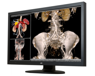 CCL650I2 | Medical Monitors | Healthcare | Professional Products | JVC